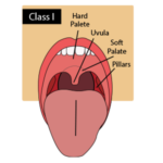 Sleep Apnea Treatment | Catonsville, MD | DCB Associates
